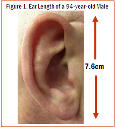 Chi's Enterprise, Inc. Newsletter Archive - Ears: A Sign of Longevity ...